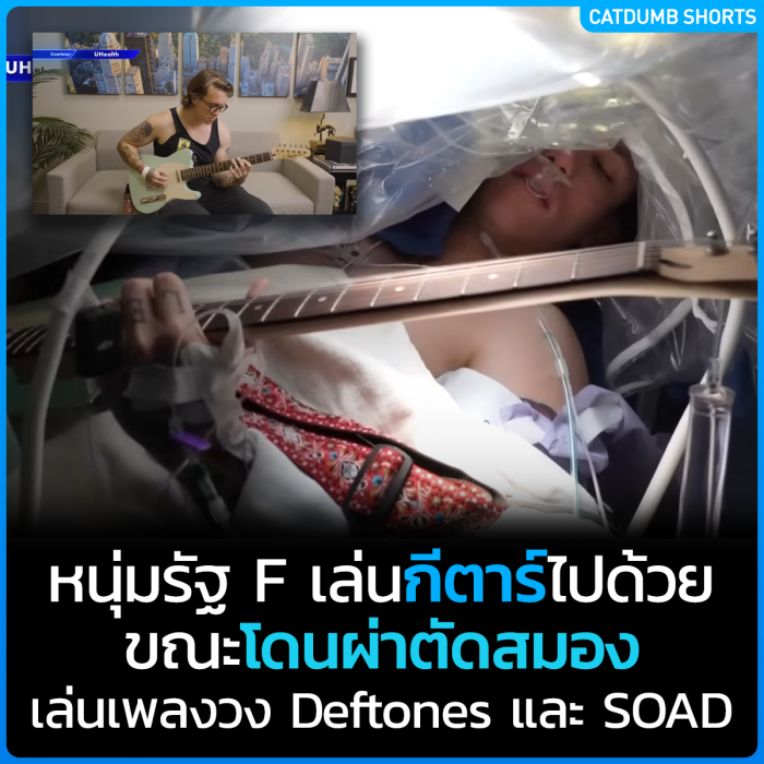 หนุ่มรัฐ F เล่นกีตาร์ไปด้วยขณะโดนผ่าตัดสมอง เล่นเพลงวง Deftones และ SOAD – CatDumb – แคทดั๊มบ์ ...